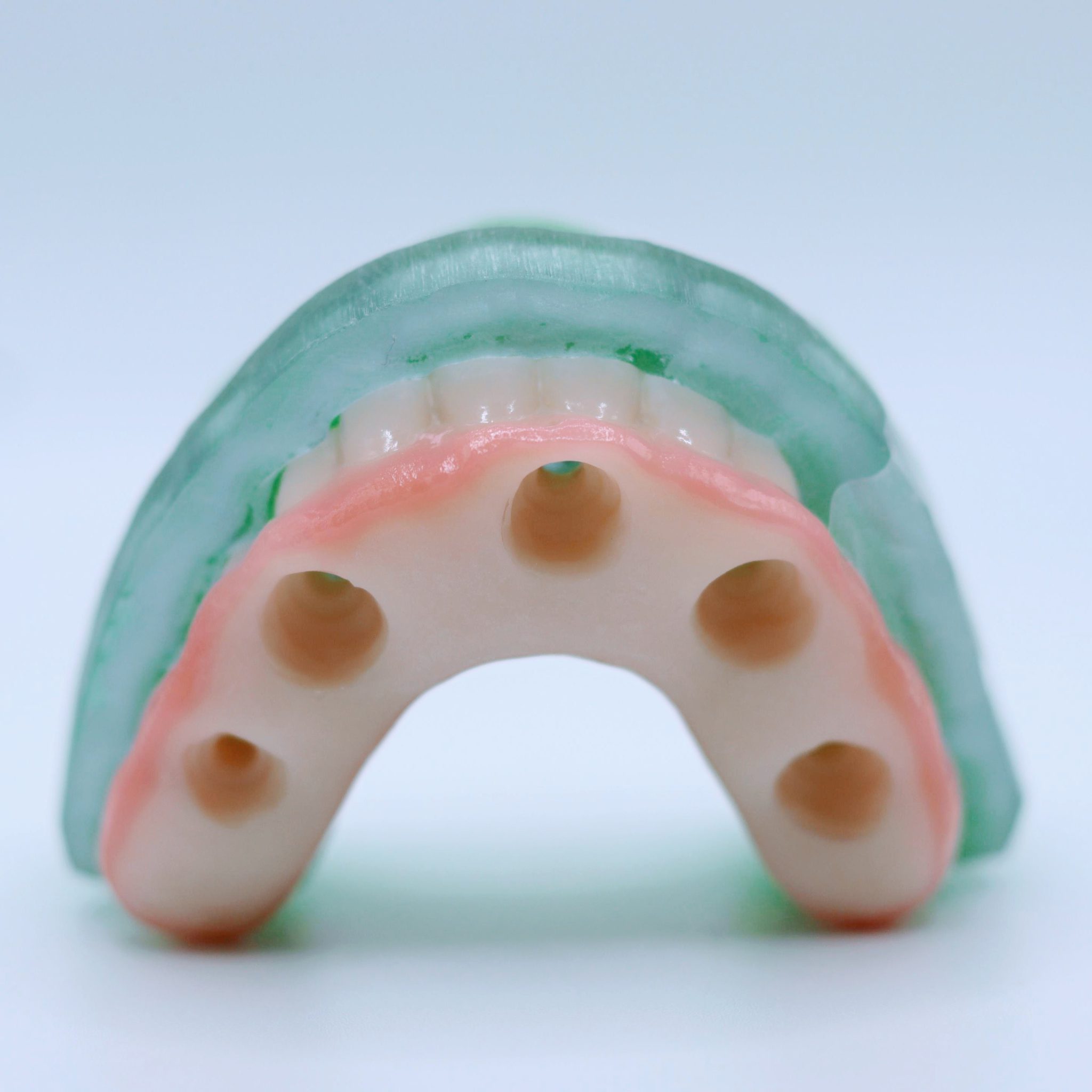 S3 Full Arch - Complete Full Arch Treatment - S3 Simple Smile Solutions ...