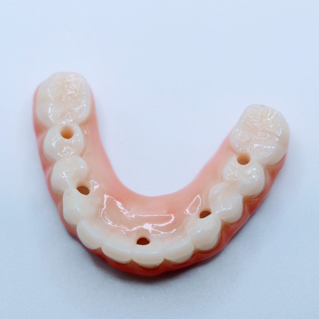 S3 Full Arch - Complete Full Arch Treatment - S3 Simple Smile Solutions ...
