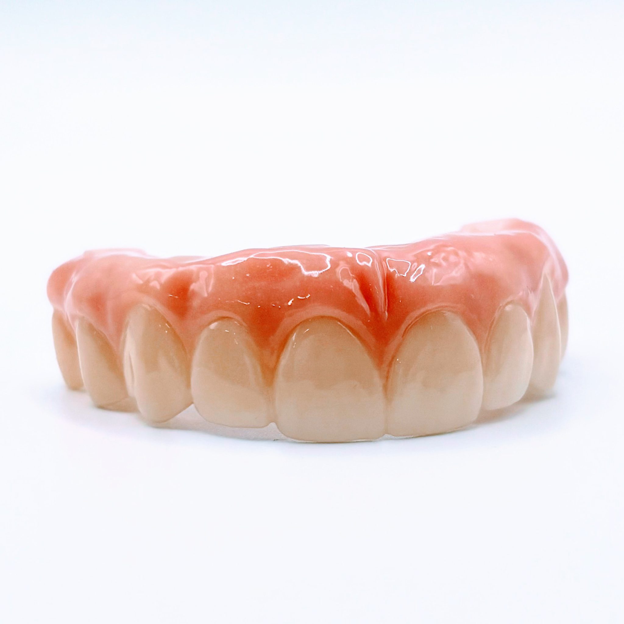 S1 Surgical Guide – 1-3 Implant Treatment | S3 Simple Smile Solutions ...